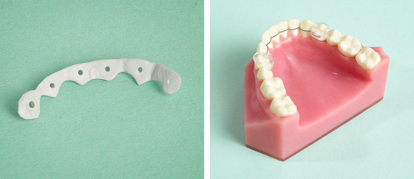 Retainers - JJ Thompson Orthodontic Appliances