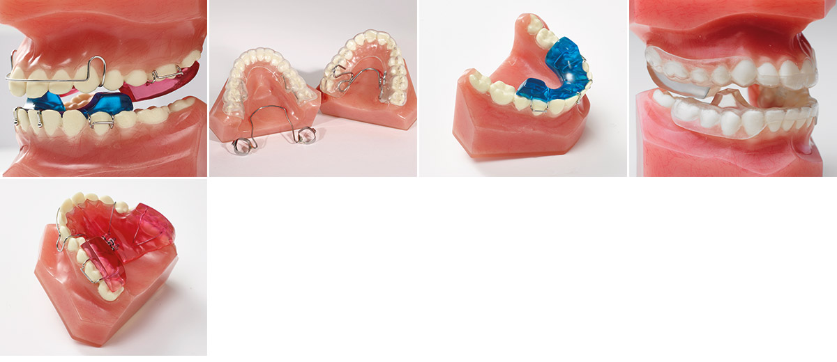 Functional appliances - JJ Thompson Orthodontic Appliances